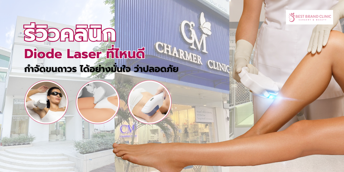 10 คลินิก Diode Laser ที่ไหนดี 2024 เลเซอร์ขนได้ถึงตอทุกส่วน
