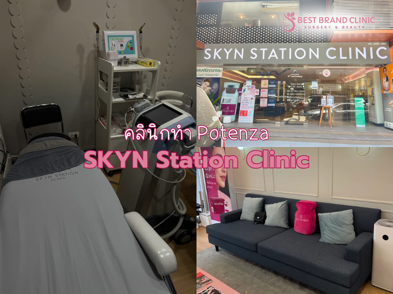 10 คลินิกทำ Potenza ที่ไหนดี 2025 ช่วยยกกระชับ ปรับผิวเนียน